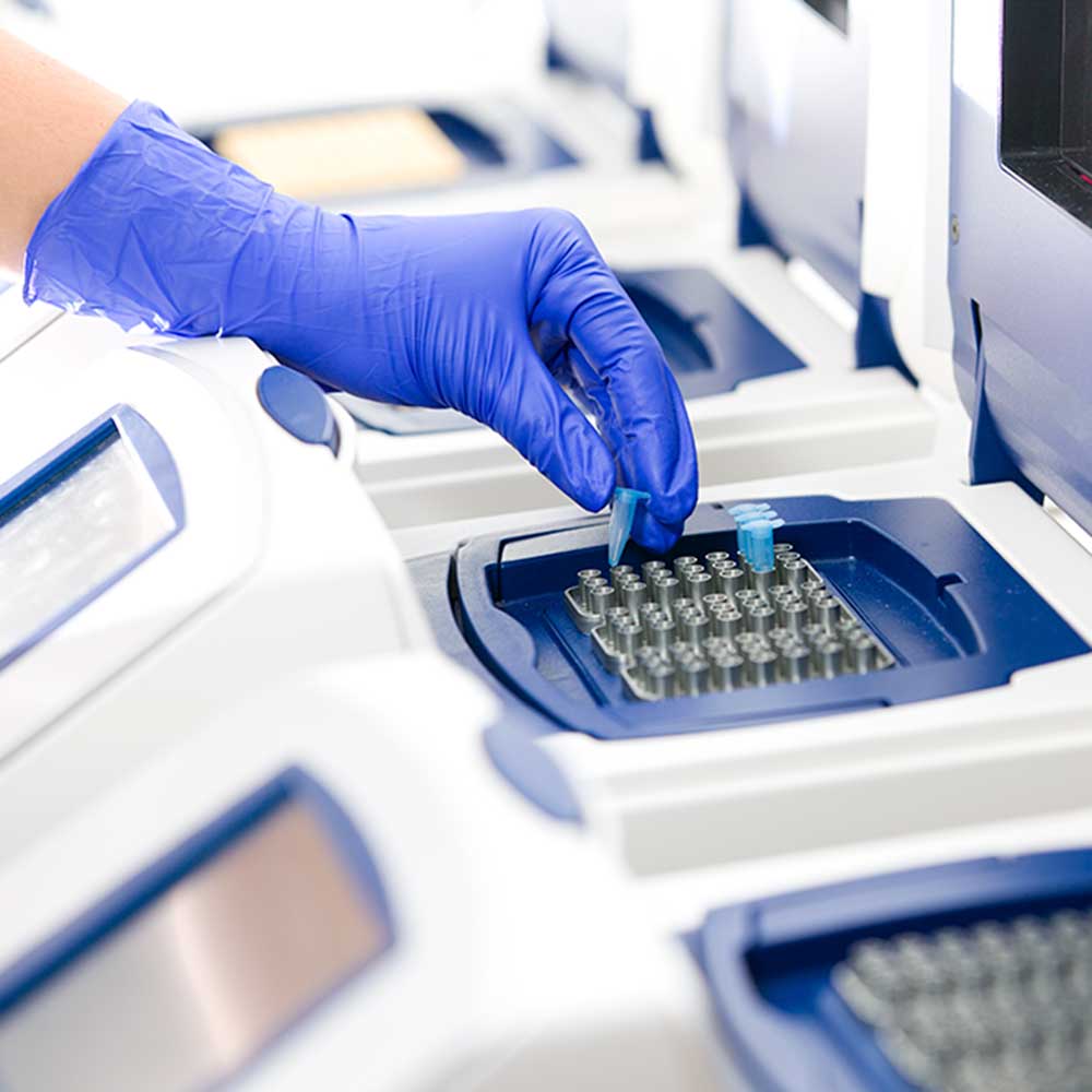 Molecular Diagnostic Parts and Consumables - Enplas Global